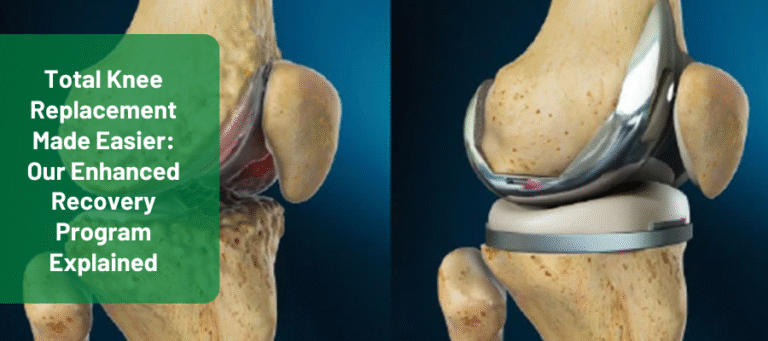 Total Knee Replacement Made Easier: Our Enhanced Recovery Program Explained