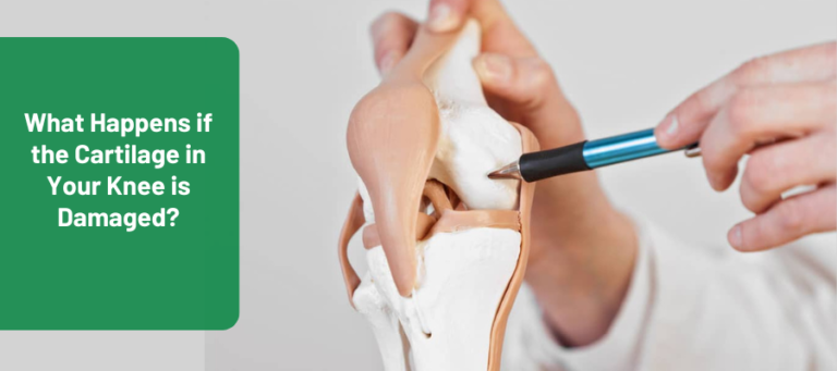 Knee Cartilage Damage : Astounding Insights